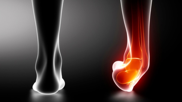 ¿Cómo se debe tratar un esguince?